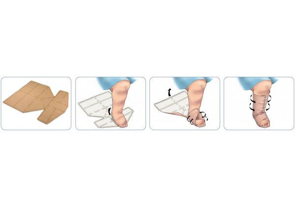 weeping edema dressing