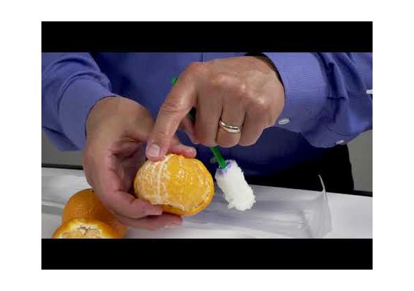 weeping edema dressing